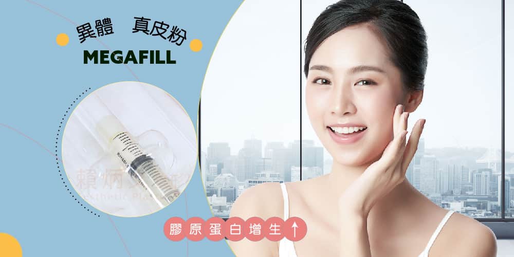 異體真皮粉 MegaFill ｜臉部填補，長效自然的非玻尿酸填充選擇 ｜ 賴炳文整形外科診所